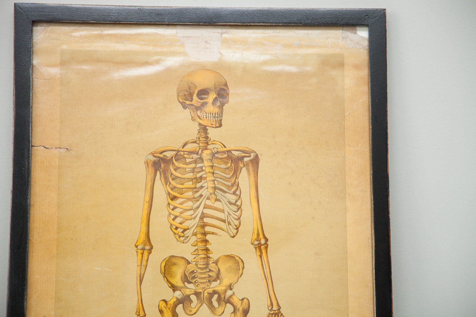 19th Century Skeleton Chart Framed
